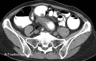 RiT radiology: August 2013