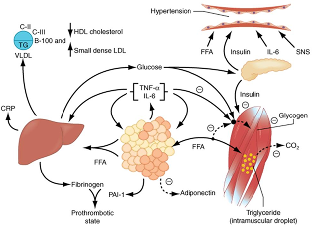 PATOFISIOLOGI SINDROM METABOLIK