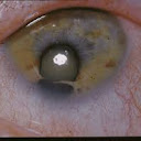 Pupula Duplex: Truth or Fake? Read more about Pupula Duplex