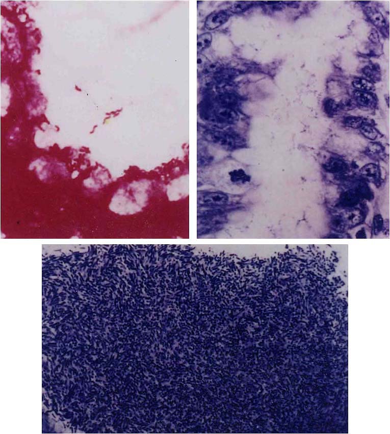 Pathology Cases: GI1 Case A New Patient Answers