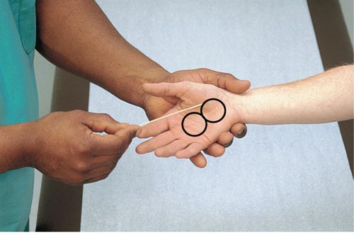 What is Graphesthesia - Definition, Test, Positive, Assessment - Health ...