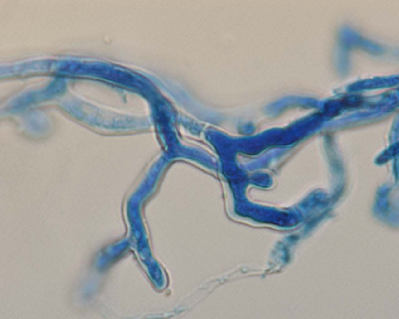 Pythium insidiosum photo collection