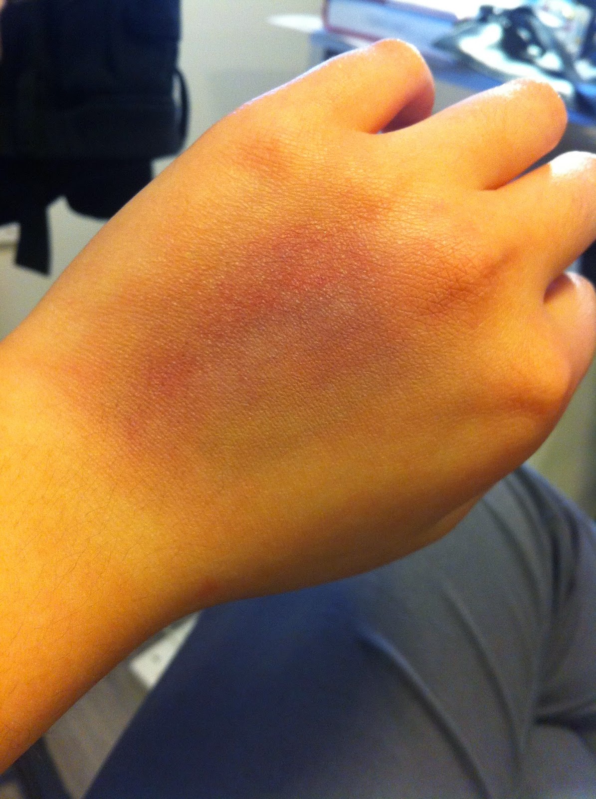 Gothic Horror: Creating cuts, scratches, bruises and perfect black eye