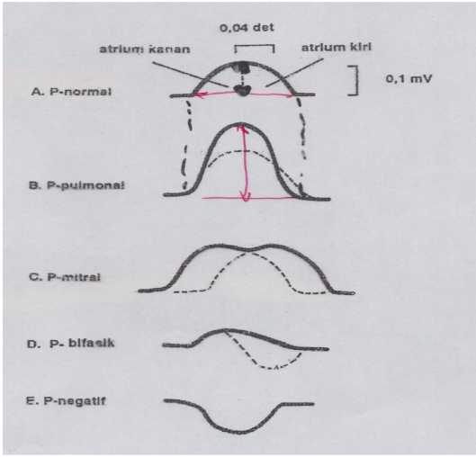 EKG dan Ilmu Dasarnya