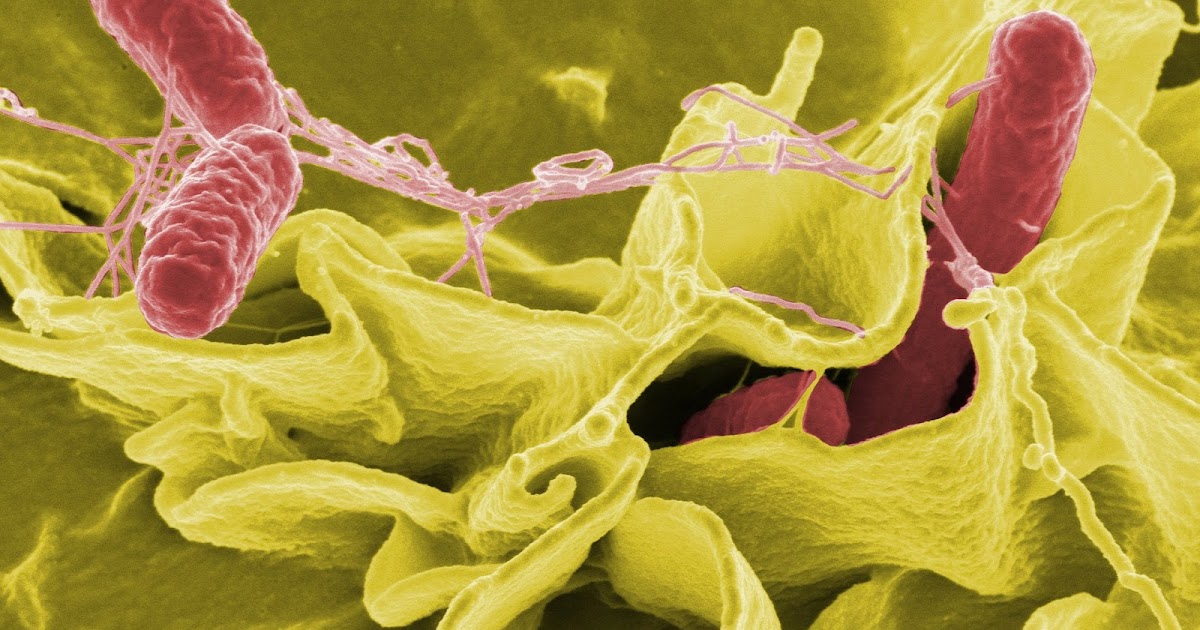 SALMONELLA - Morphology, Laboratory diagnosis, Cultural characteristics ...