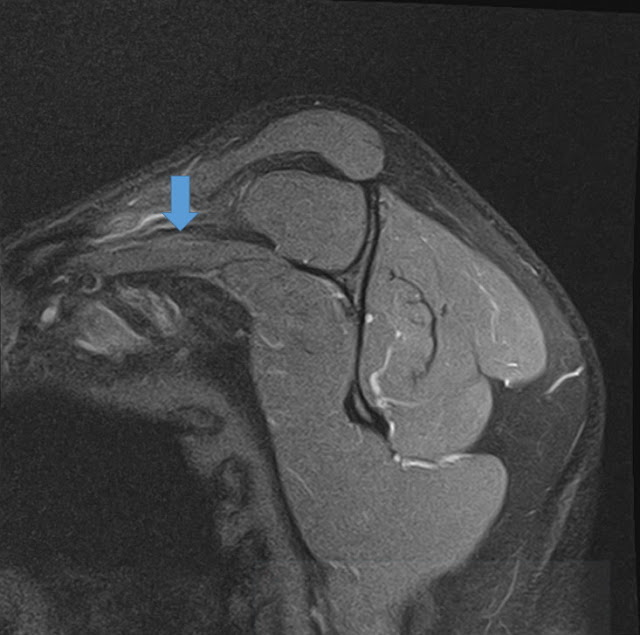 Ultimate Radiology : How strong is your 'Shoulder Anatomy'