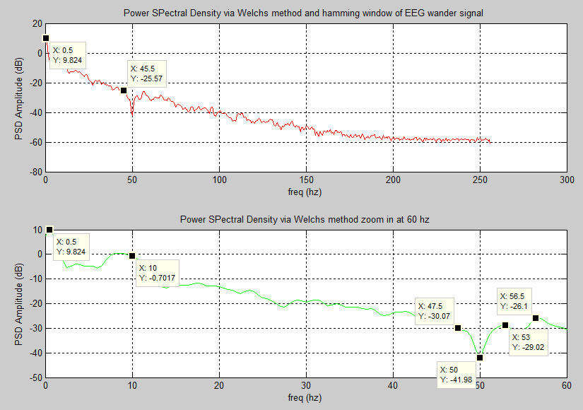Biomedical Signal And Image Processing Projects Using Matlab And Labview Tools Matlab Code To