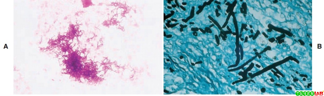 [Parasitology] Atlas of Medically Significant Fungi | Free Medical Atlas