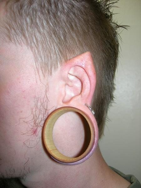 Pembedahan mendapatkan telinga Elf