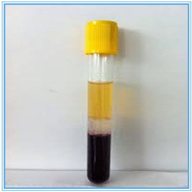 O Sangue e as partes que o compõem - Análises Clínicas.com