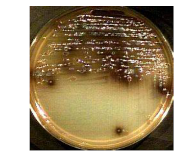 Mikrobiologi : Uji Salmonella: Uji Salmonella