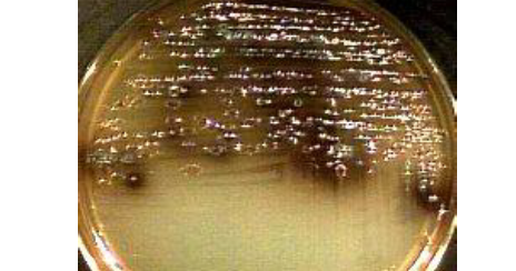 Mikrobiologi : Uji Salmonella: Uji Salmonella