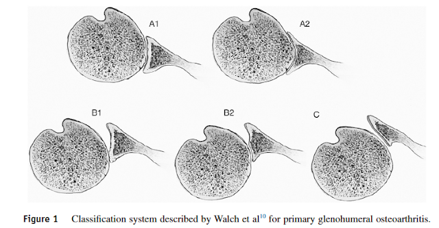 UW Shoulder and Elbow Academy: Imaging the arthritic glenoid