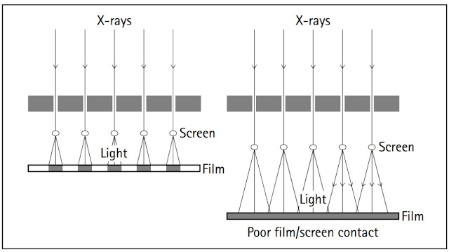 Clark's Radiography: Image Sharpness
