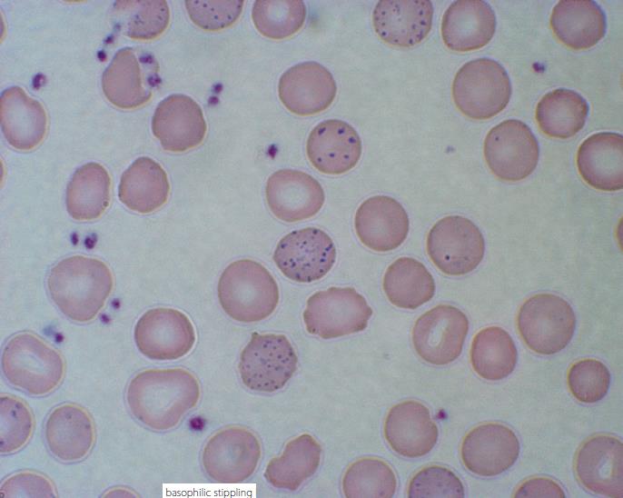 VETERINARY HEMATOLOGY DEXTERVET: Basophilic stippling