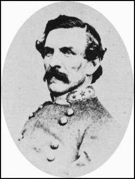 Tim Kent's Civil War tales: James Conner: The General and His Unlucky Leg