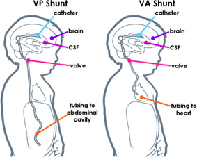 A Journey of Grace: June 2012