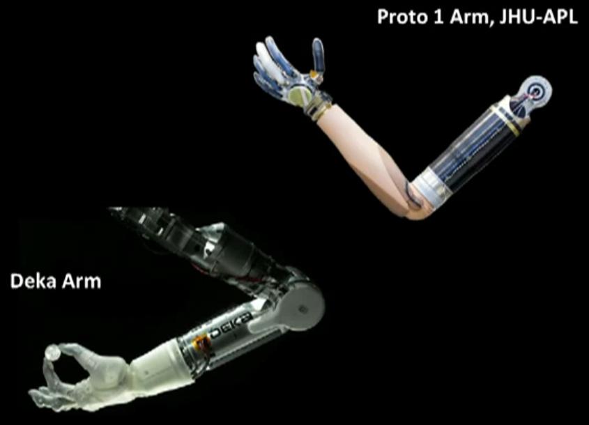 REHABILITACIÓN Y MEDICINA FÍSICA. Mirando al futuro.: La prótesis ...