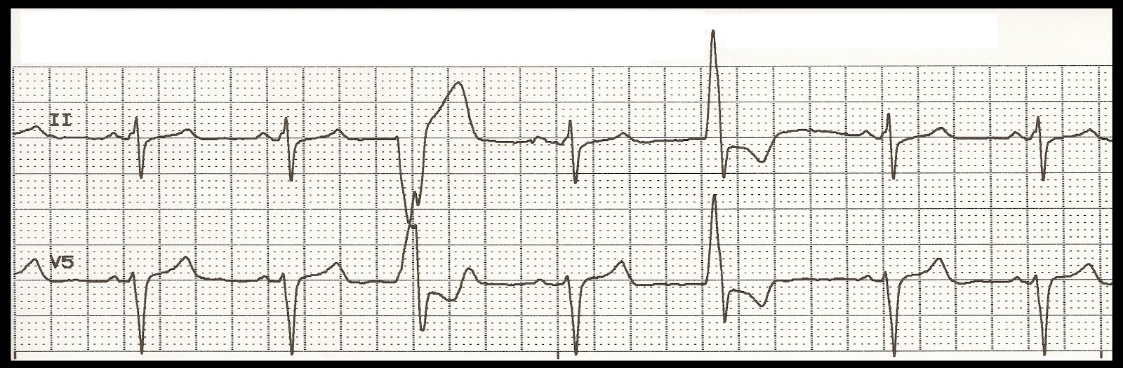 EKG Rhythm Strip Quiz 123
