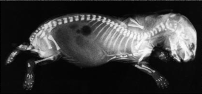 Hyder Ismail: A short History of X-rays
