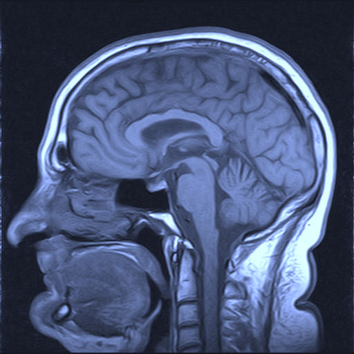 Philosophical Disquisitions: Mind-Body Physicalism (Part Four): Absent ...