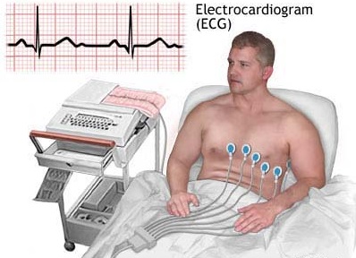 ELEKTROKARDIOGRAF (Electrocardiograph-EKGECG) - Artikel dan Bahan