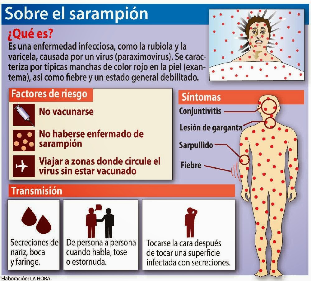 Enfermedades : Sarampión