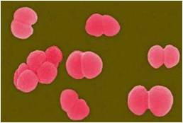 ENFERMEDADES DE TRANSMISIÒN SEXUAL: ENFERMEDADES DE TRANSMISION SEXUAL