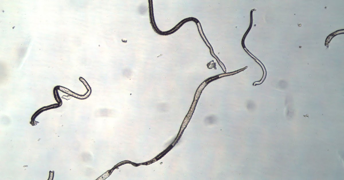 Micro tincion vegetal: OBSERVACIÓN DE TRICOMAS