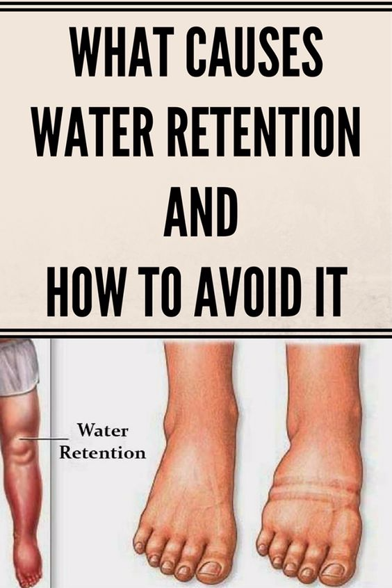 WHAT CAUSES WATER RETENTION AND HOW TO AVOID IT HEALTH BLOG