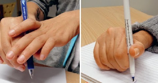 Reconstructive Hand Surgery In Tetraplegia: A Handful of Freedom