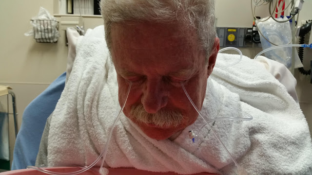 Patrick Tillett: Fire Sticks Versus My Eye Balls