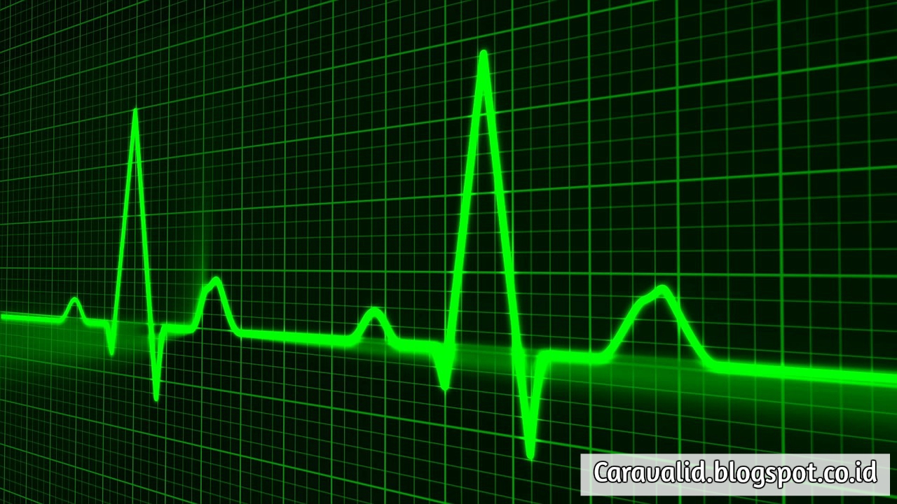 Cara Periksa Denyut Nadi Manusia Dengan Mudah Dan Lengkap - CaraValid