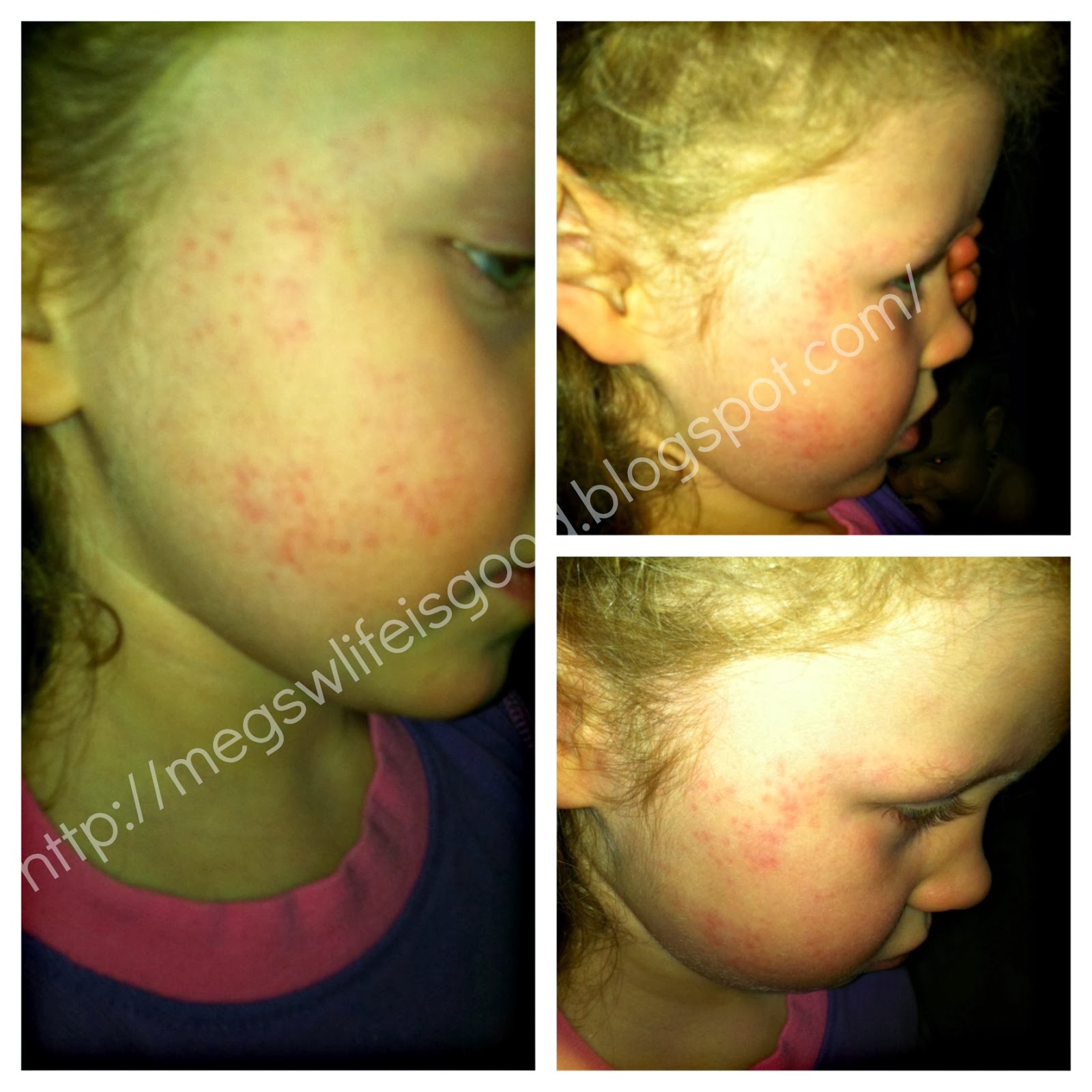 Strawberry Allergy - Quiet In The Chaos