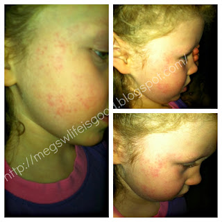 Strawberry Allergy - Quiet In The Chaos