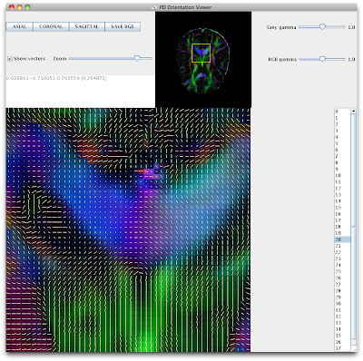 DTI Quality Control - Part 2: Tensor fitting | Diffusion Imaging; Introduction, tutorials and ...
