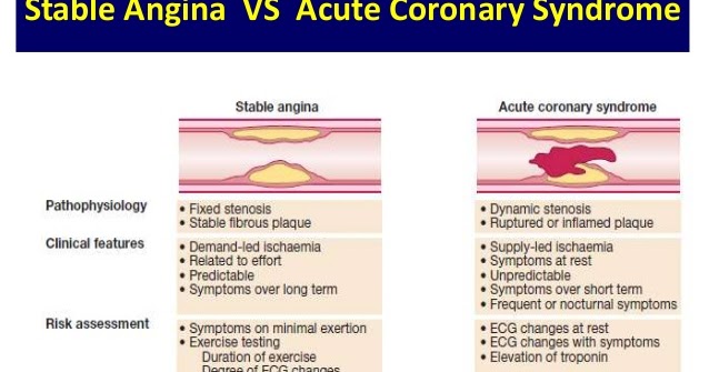 Stable angina
