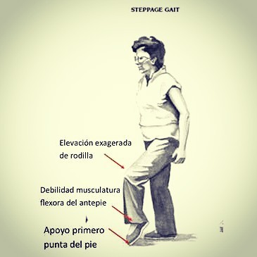 Evaluación Fisioterapeutica: II CORTE