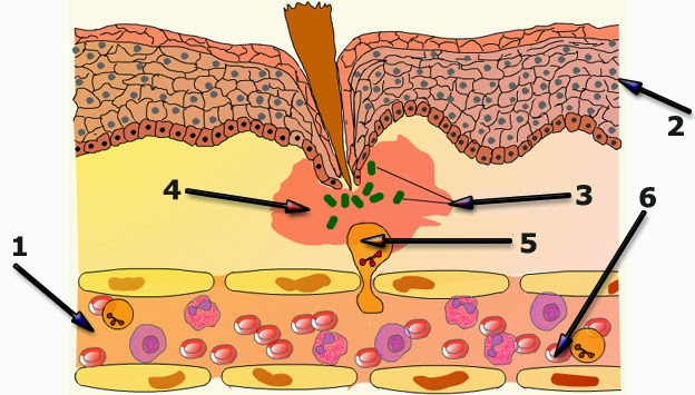 Inflamación y La Descripción de cada una de las etapas.