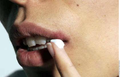 Adios Queilitis Angular: ¿Que Es y Como se Trata la Queilitis Angular?