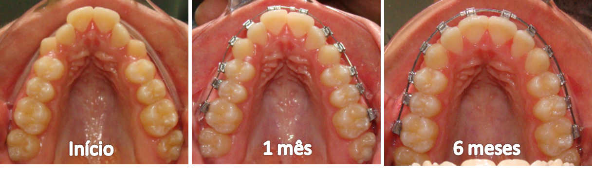 InterOrthos - Ortodontia Padrão Internacional