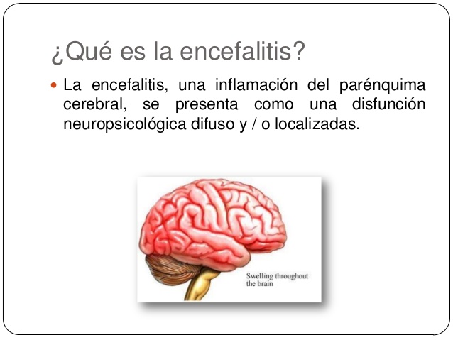 Neuropsicologia: ENCEFALITIS