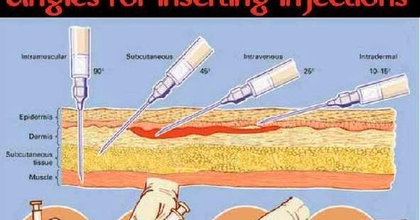 Injeksi INtravena dan IntraMUscular ~ Midwife DAHLIA