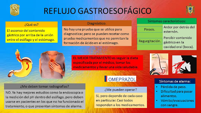 DIVULGACIÓN CIENTÍFICA UG: Reflujo Gastroesofágico