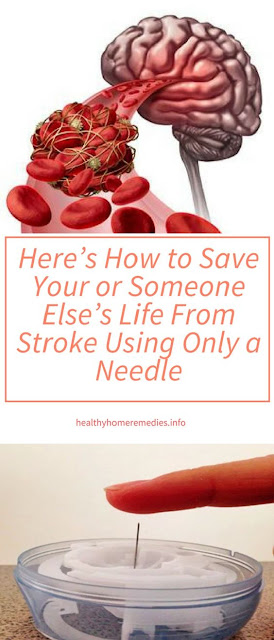 HERE’S HOW TO SAVE YOUR OR SOMEONE ELSE’S LIFE FROM STROKE USING ONLY A ...
