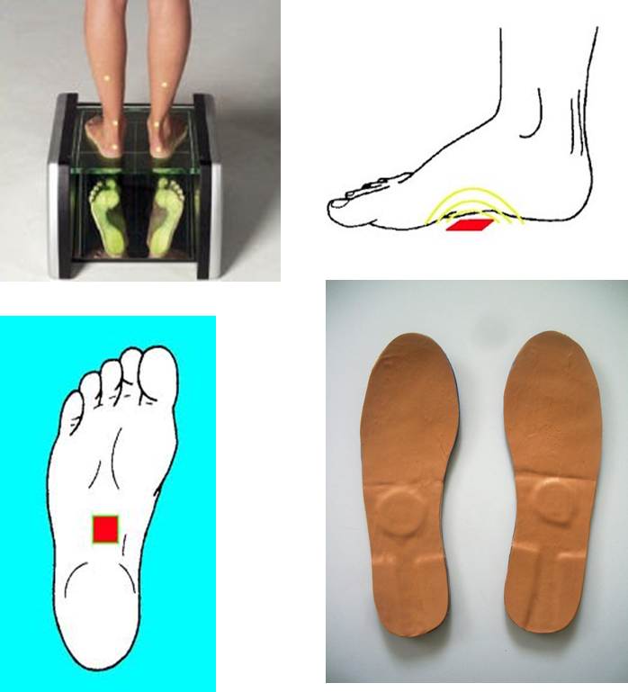 MEDICINA OSTEOPATICA Trujillo - PERU: NEUROSTAB