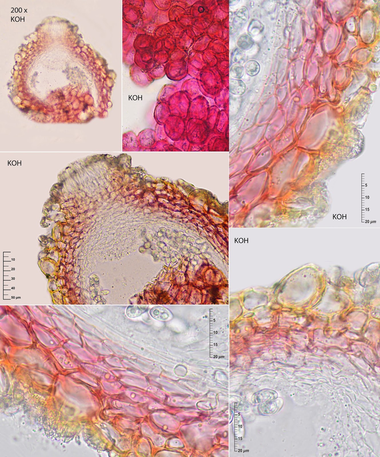 Neocosmospora cf haematococca (Berk. & Broome) Nalim, Samuels & Geiser ...