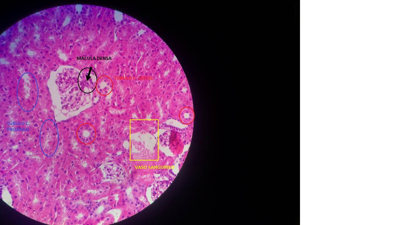 HISTOLOGIA90: RIM NORMAL E GLOMERULONEFRITES