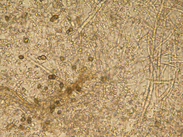 NMSU Plant Clinic: Tubakia Leaf Spot