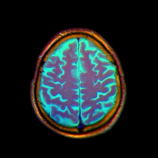 Nevit's blog: Color MRI of the Brain